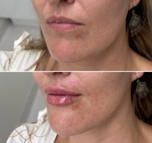 Shellharbour Skin - Skin Cancer & Aesthetic Medicine Clinic