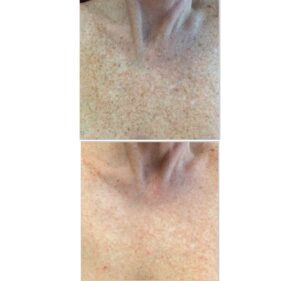 Gallery – Shellharbour Skin