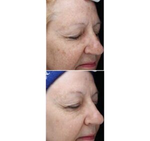 Gallery – Shellharbour Skin